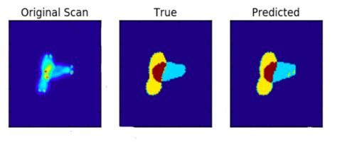 Segmenting Overlapping Chromosomes Using Deep Learning