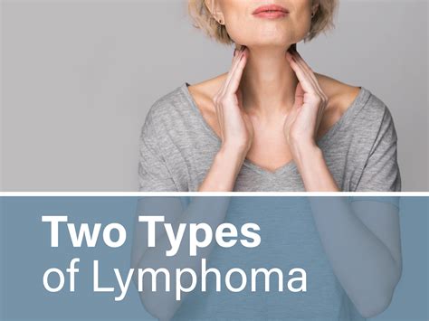 Know The Two Types Of Lymphoma Hodgkin And Non Hodgkin Golden State