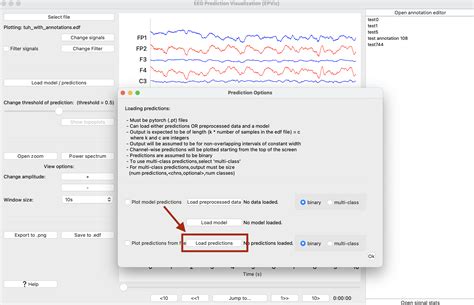 EPViz Neural Systems Analysis LaboratoryNeural Systems Analysis Laboratory