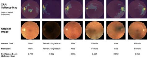 Predicting Sex From Retinal Fundus Photographs Using Automated Deep Predicting Sex From Retinal Fundus Photographs Using Automated Deep