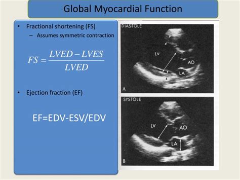 PPT EVALUATION OF SYSTOLIC FUNCTION OF LEFT VENTRICLE BY ECHOCARDIOGRAPHY PowerPoint