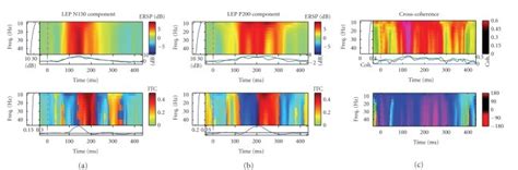 Left And Middle Panels Event Related Log Power Spectral