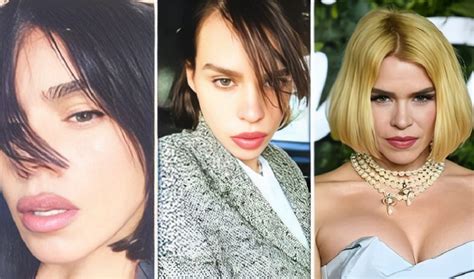 Billie Piper Botox Before And After Plastic Surgery Photos