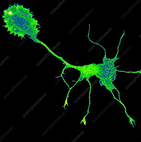 Single Brain Cell Showing Cytoskeleton Light Micrograph Stock Image C048 9523 Science