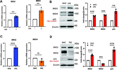 The Epigenetic Reader Brd2 Mediates Cholangiocyte Senescence Via Interaction With Ets1 Pmc