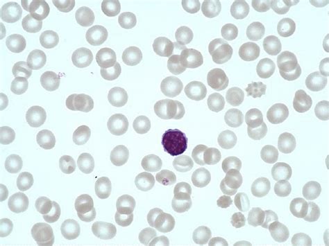 Lymphocyte Horiba
