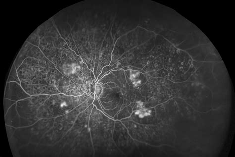 Why Optomap Dr Scott And Associates