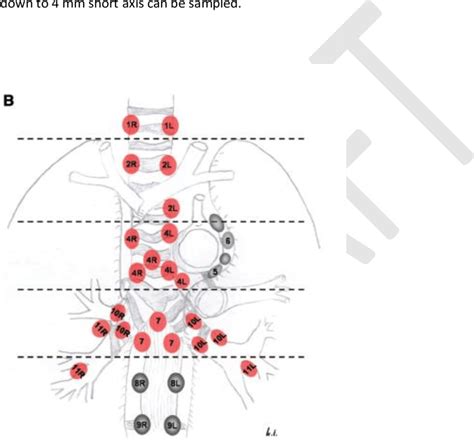 Lymph Node Stations Accessible By Transbronchial Needle Aspiration Are