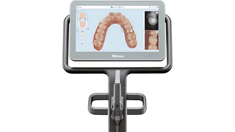 Itero Element 5d Review Digital Dentistry Blog Online Training