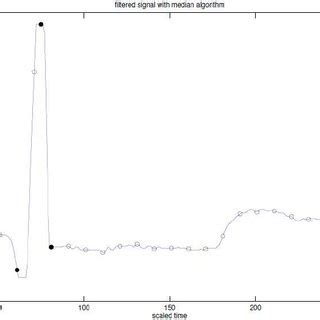 Median Algorithm Used For Data Reduction And Consecutive Points Are Download Scientific
