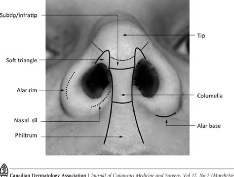 Figure 5 From Surface Anatomy Of The Nose For The Dermatologist