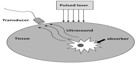 Schematic Diagram Of Pat Download Scientific Diagram
