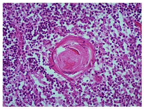 Endocrine Histology Flashcards Quizlet