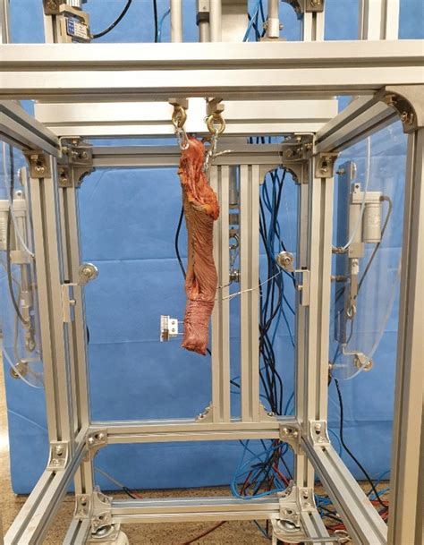 A Transradial Amputation Was Performed On Each Of The Ten Upper Limb