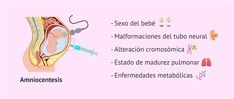 Fisura Bolsa Amniotica Semana 38 Online