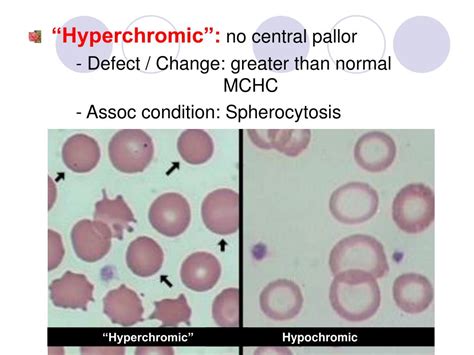 Ppt Red Blood Cells Powerpoint Presentation Free Download Id745427