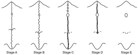 Jcm Free Full Text Analysis Of The Frequency And Correlated Factors Of Midpalatal Suture