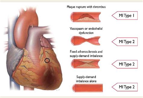 Nucleus Raphe Magnus Semantic Scholar