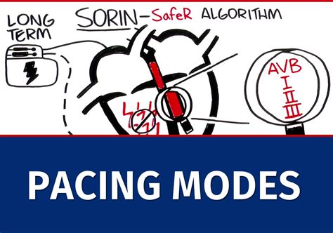 4 Pacing Modes Microport Academy