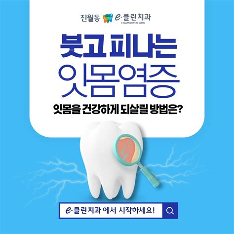 이클린치과 저희 E클린치과는 주사도 살살 안 아프게 잘 놓는답니다 광주사랑니발치 풍암동치과 광주치과잘하는곳 백운동치과 광주임플란트가격 효천치과 광주턱관절