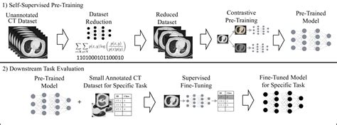 Cl Mri Self Supervised Contrastive Learning To Improve The Accuracy Of Undersampled Mri