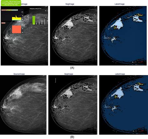 Segmentation Results Obtained By The Proposed Method A On The Gpus