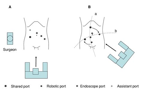 The Set Up Of The Robotic Cart And The Location Of The Ports For Low