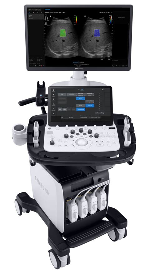 삼성메디슨 고급형 초음파 진단기기 V8 출시