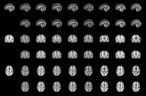 Setgen Scalable And Efficient Template Generation Framework For