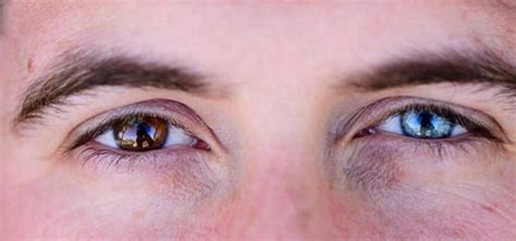 Unlocking The Genetic Code Ai Reveals New Insights Into Psychiatric