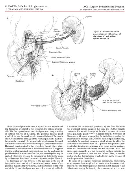 Acs0709 Injuries To The Pancreas And Duodenum Pdf