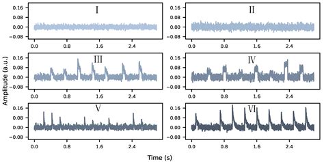 An Event Recognition Method For A Φ Otdr System Based On Cnn Bigru Network Model With Attention