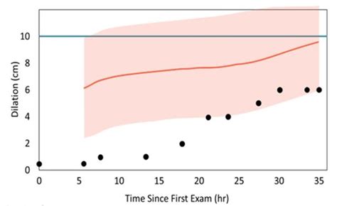 Multifactorial Labor Curve Multifactorial Labor Curve