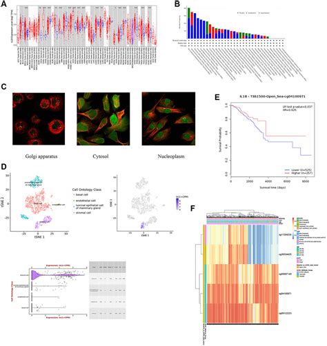 A Novel Signature Incorporating Genes Related To Lipid Metabolism And Immune For Prognostic And
