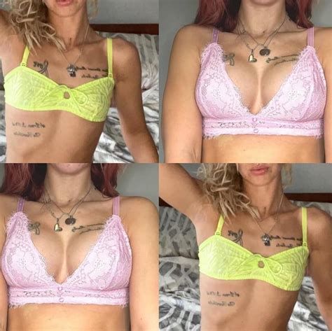 Extra High Profile Breast Implants