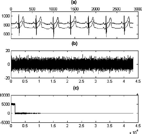 Figure 1 From Electrocardiogram Compression Method Based On The