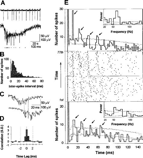 Figure 1 From Fast Network Oscillations In The Newborn Rat Hippocampusin Vitro Semantic Scholar