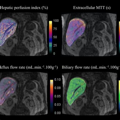 Example Of Perfusion Parametric Maps Arterial Portal And Total