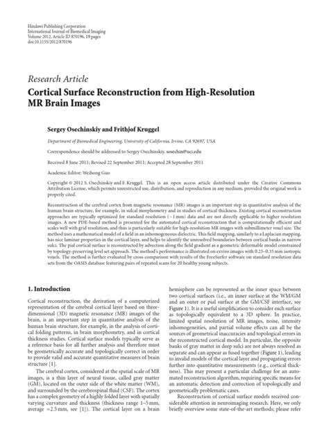 Research Article Cortical Surface Reconstruction From High Resolution Mr Brain Images Pdf