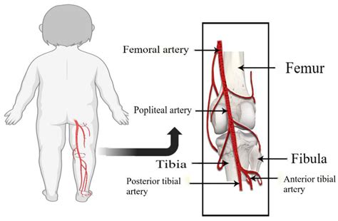 Popliteal Artery Diagram