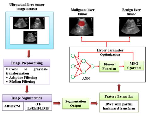 An Efficient Discrete Wavelet Transform Based Partial Hadamard Feature Extraction And Hybrid