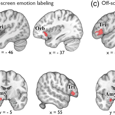 A Results Of The Individual Neuroimaging Meta‐analysis On Emotion