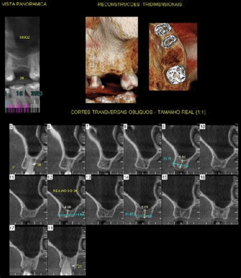 CT Scan Before Surgery Download Scientific Diagram