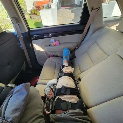 Navigating Knee Replacement Understanding Travel Restrictions And