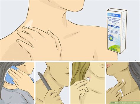 Teeth Marks On Neck