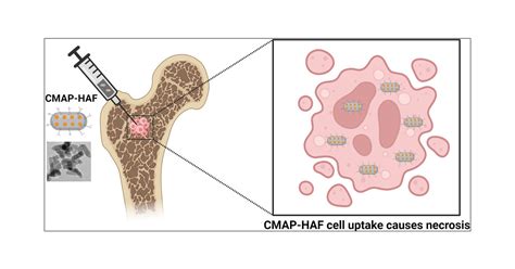 Internalized Hydroxyapatite Nanoparticles Conjugated With A Modified Form Of Curcumin