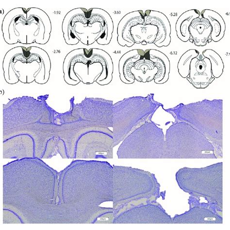 Pdf Lesions Of Retrosplenial Cortex Spare Immediate Early Gene Activity In Related Limbic