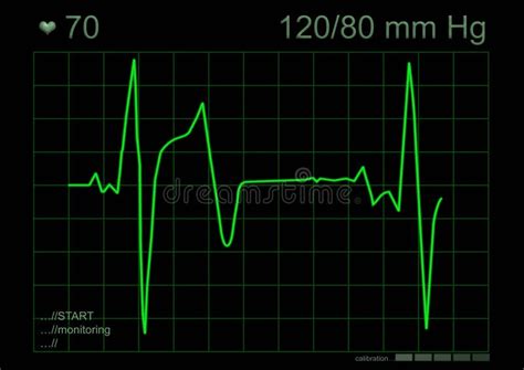ECG Graph Stock Illustration Illustration Of Cardiology 1058678