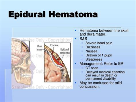 Ppt Head Injuries Powerpoint Presentation Free Download Id6384426