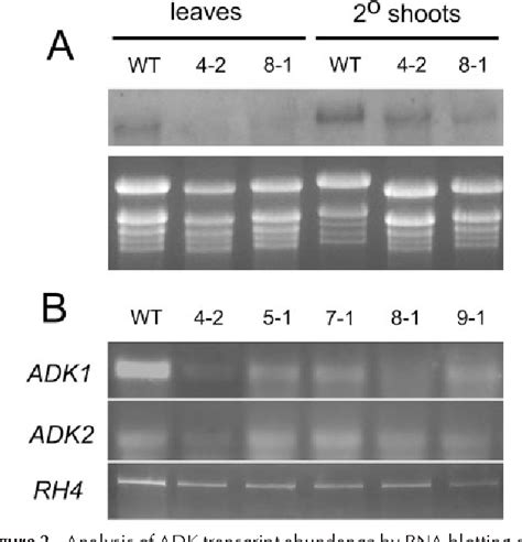 Figure 3 From Adenosine Kinase Deficiency Is Associated With